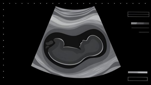 The Second Ultrasound: The Comprehensive Fetal Anatomy Scan – Nurturing ...